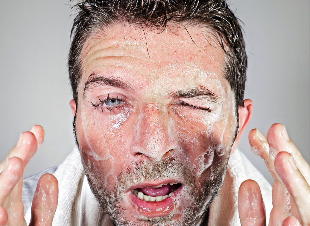 Is Blepharitis Caused By Poor Hygiene? – Balmonds