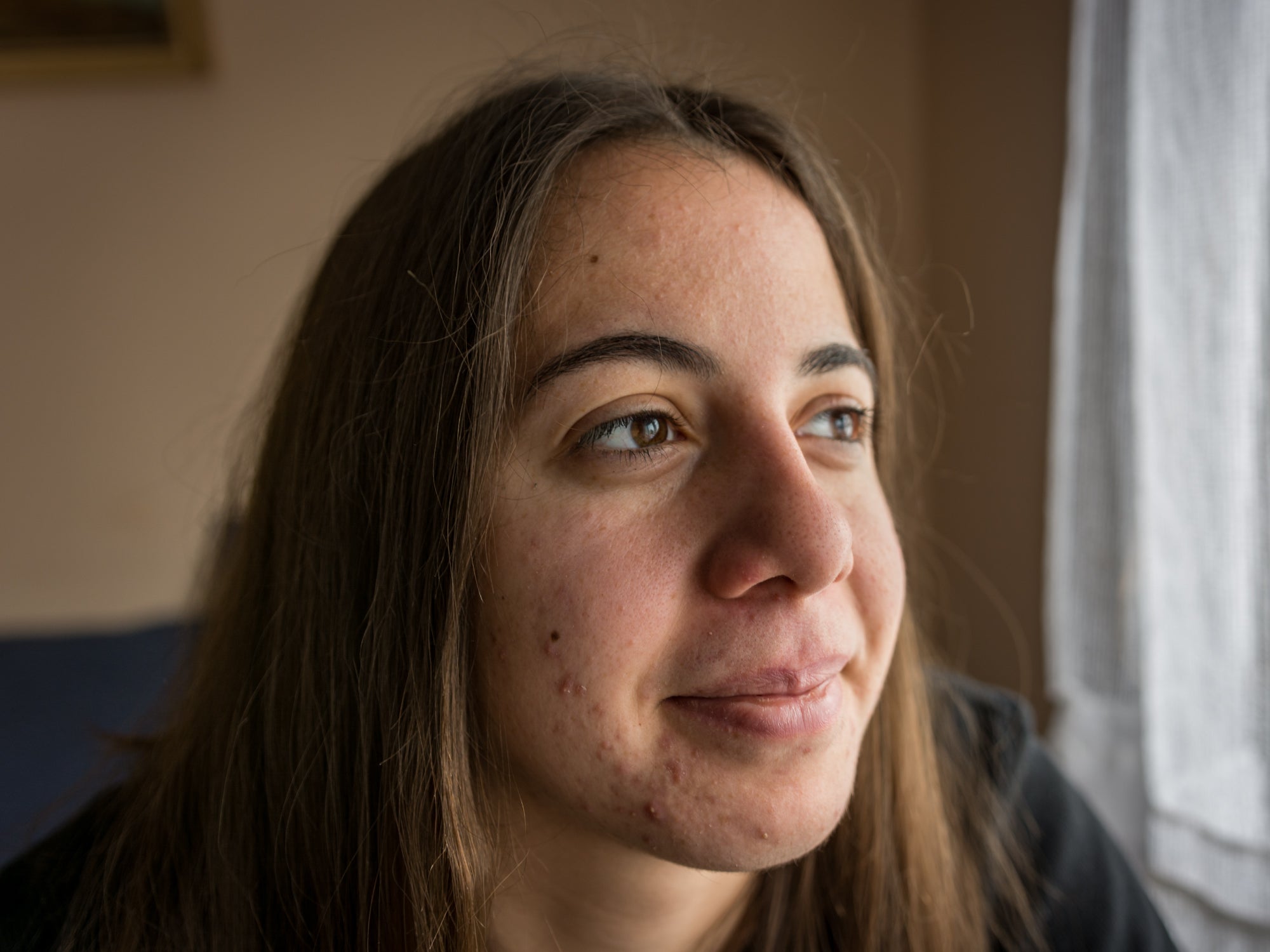 What Do Chemo Rashes Look Like? – Balmonds